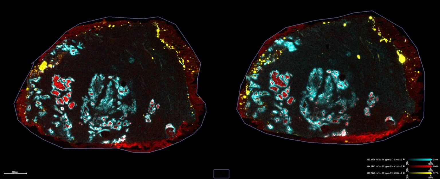 Turku Metabolomics Core Enhances MALDI Imaging with New Sprayer – Turku Bioscience Centre